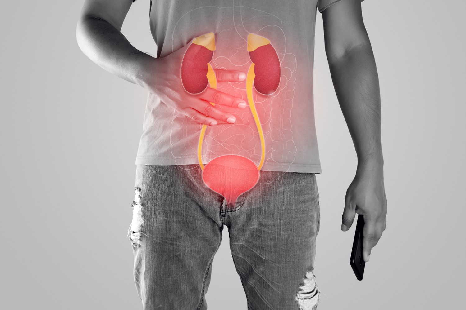 Understanding Nephrotic Syndrome: Causes, Symptoms, and Treatment ...